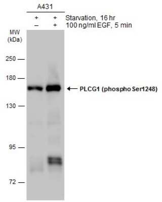 PLC-gamma 1 [p Ser1248] Antibody (NBP3-13252): Novus Biologicals